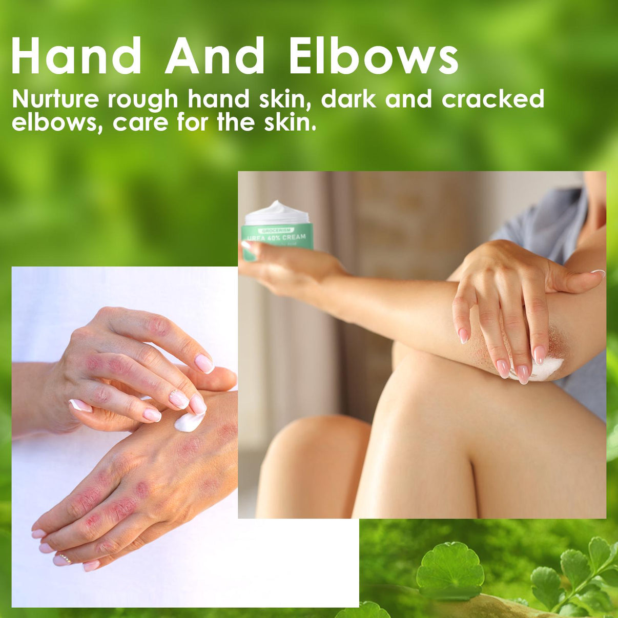 Grocerism Urea Cream 40 Percent For Feet Plus 2% Salicylic Acid 5.29 o